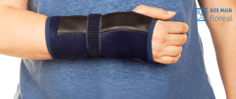 Fracture du poignet chez l’adulte : Symptômes, diagnostic et traitements